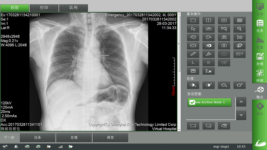 奕瑞科技 | IRAY — X光影像核心部件方案提供商-Technology